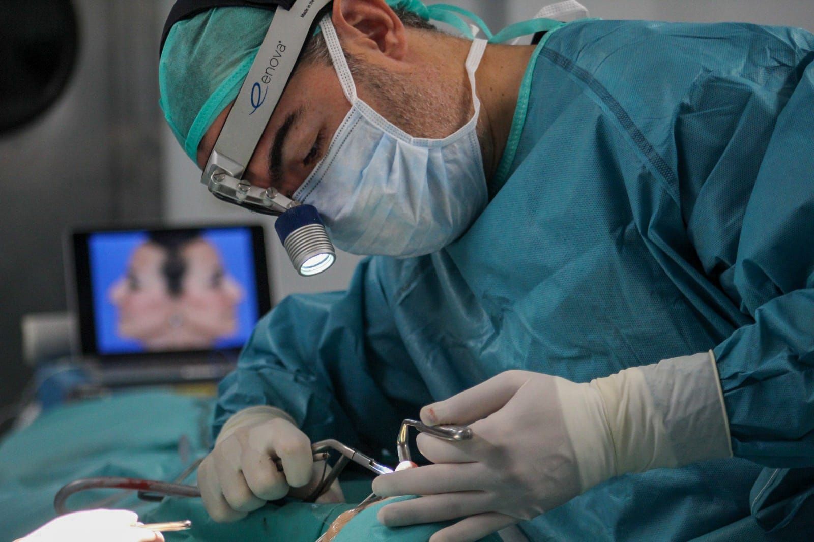 Queiloplastia o cirugía de los labios: todo lo que debes saber | Doctor ...